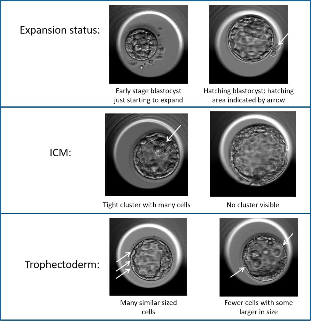 Egg and Embryo Quality - What You Should Know Before Treatment
